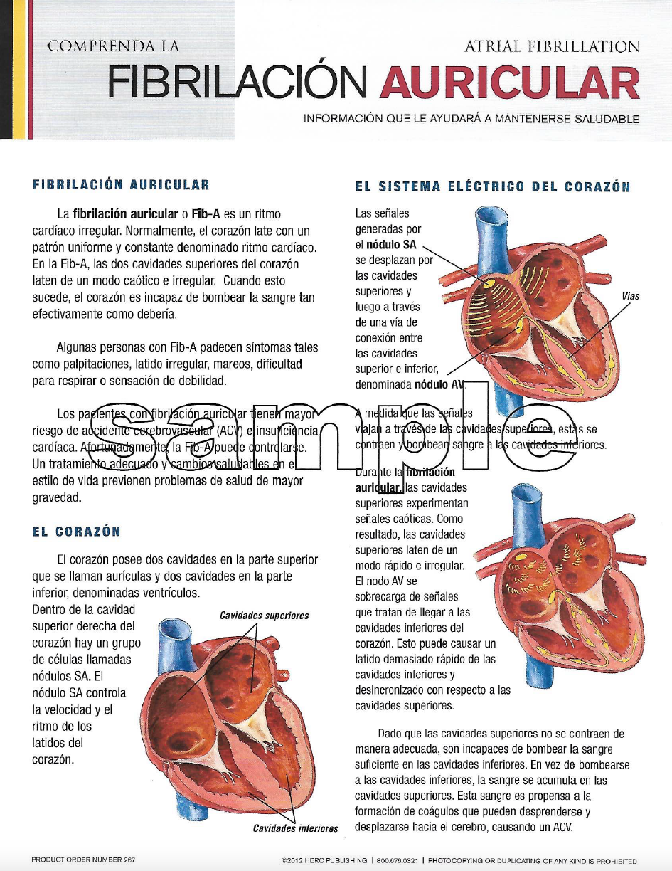 Atrial Fibrillation - Spanish - HERC Publishing